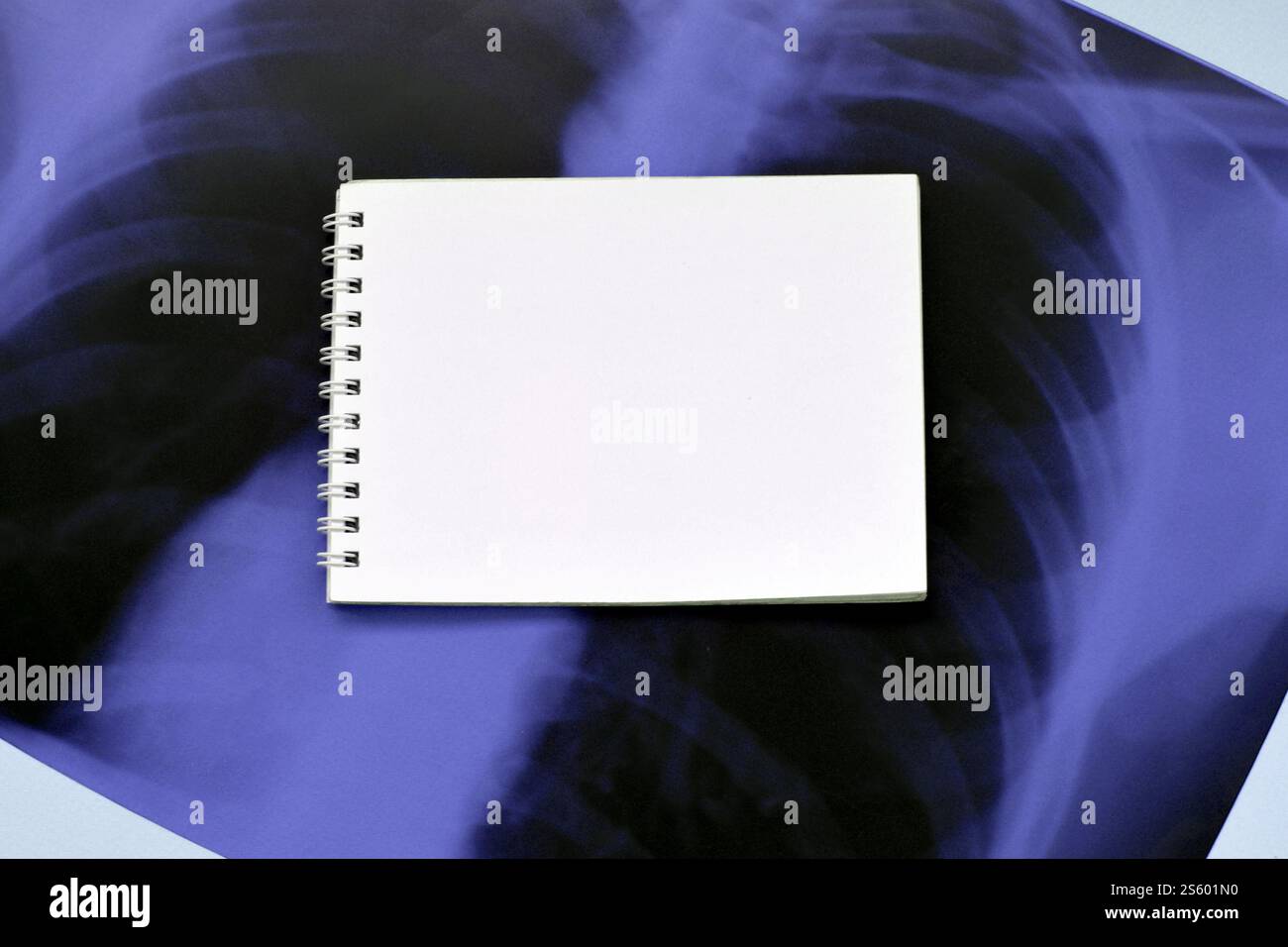 X-Ray film image of human chest for a medical diagnosis and empty blank ...