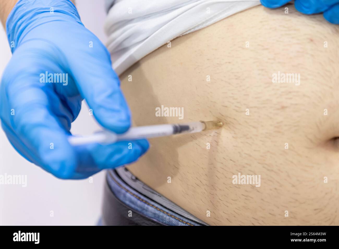 How to properly give yourself subcutaneous injection in your stomach ...