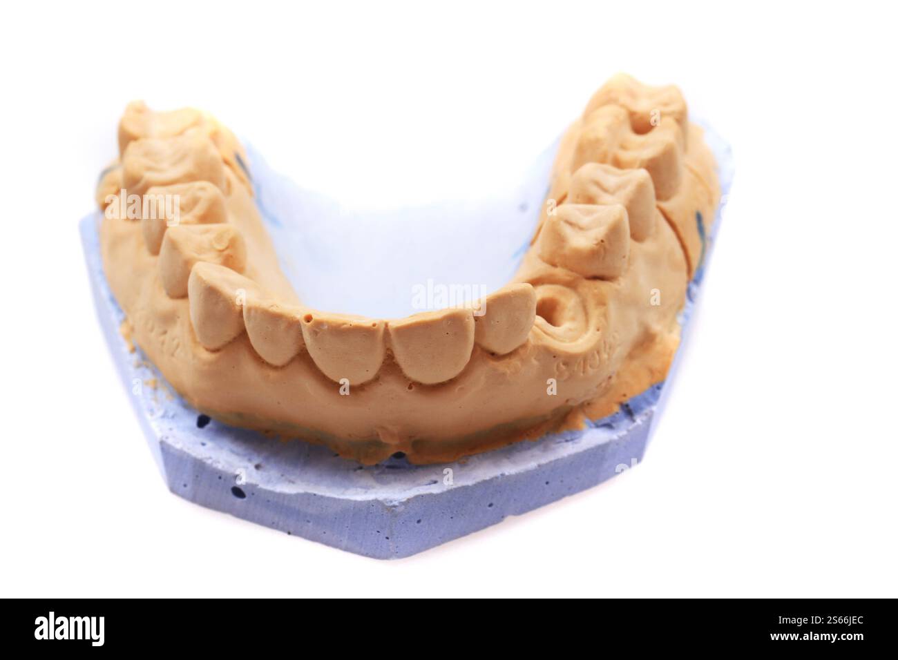 model of tooth prothesis isolated on white background Stock Photo - Alamy