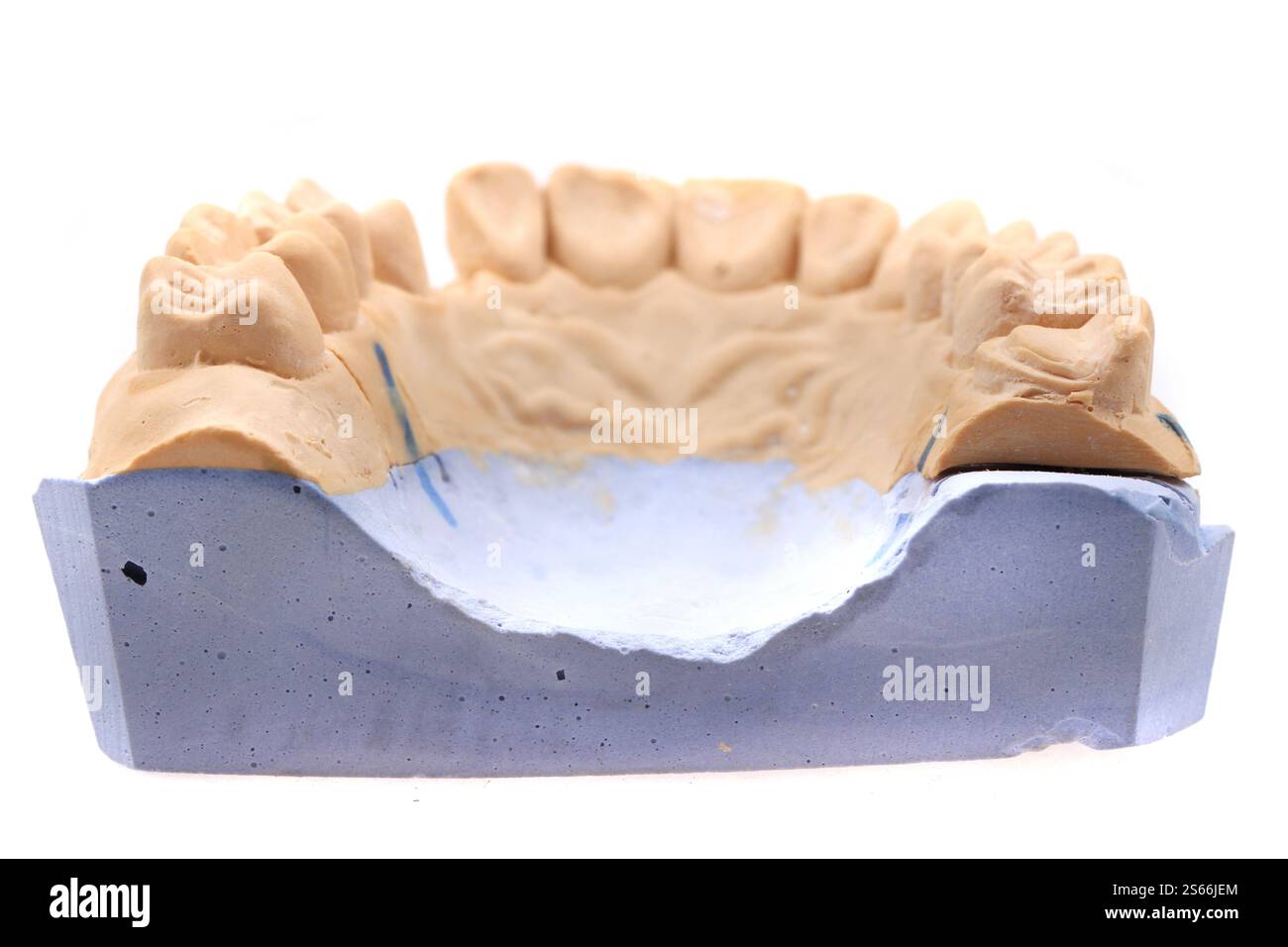 model of tooth prothesis isolated on white background Stock Photo - Alamy