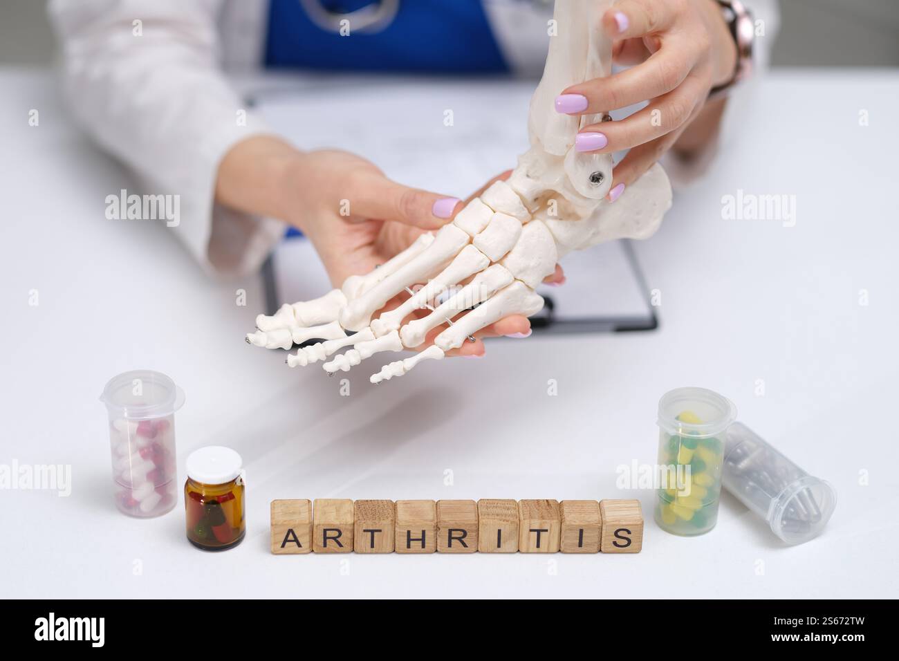 A Comprehensive Overview of Arthritis Including Its Anatomy, Symptoms ...