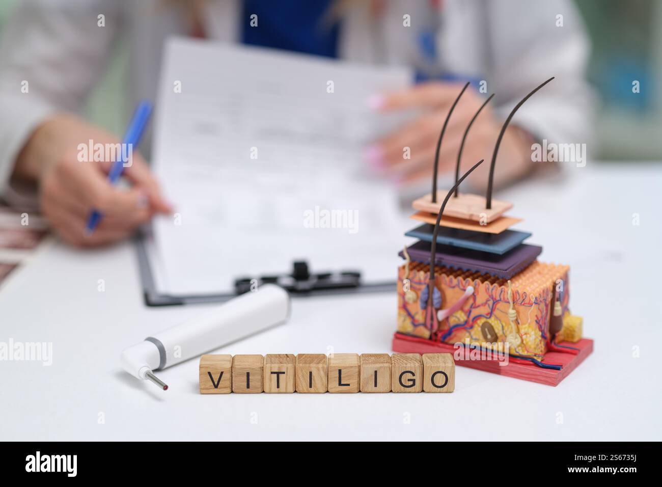 Gaining Deeper Insights into Vitiligo A Comprehensive Skin Model and ...