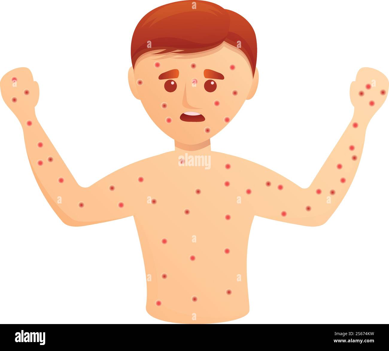 Boy skin rash icon. Cartoon of boy skin rash vector icon for web design ...