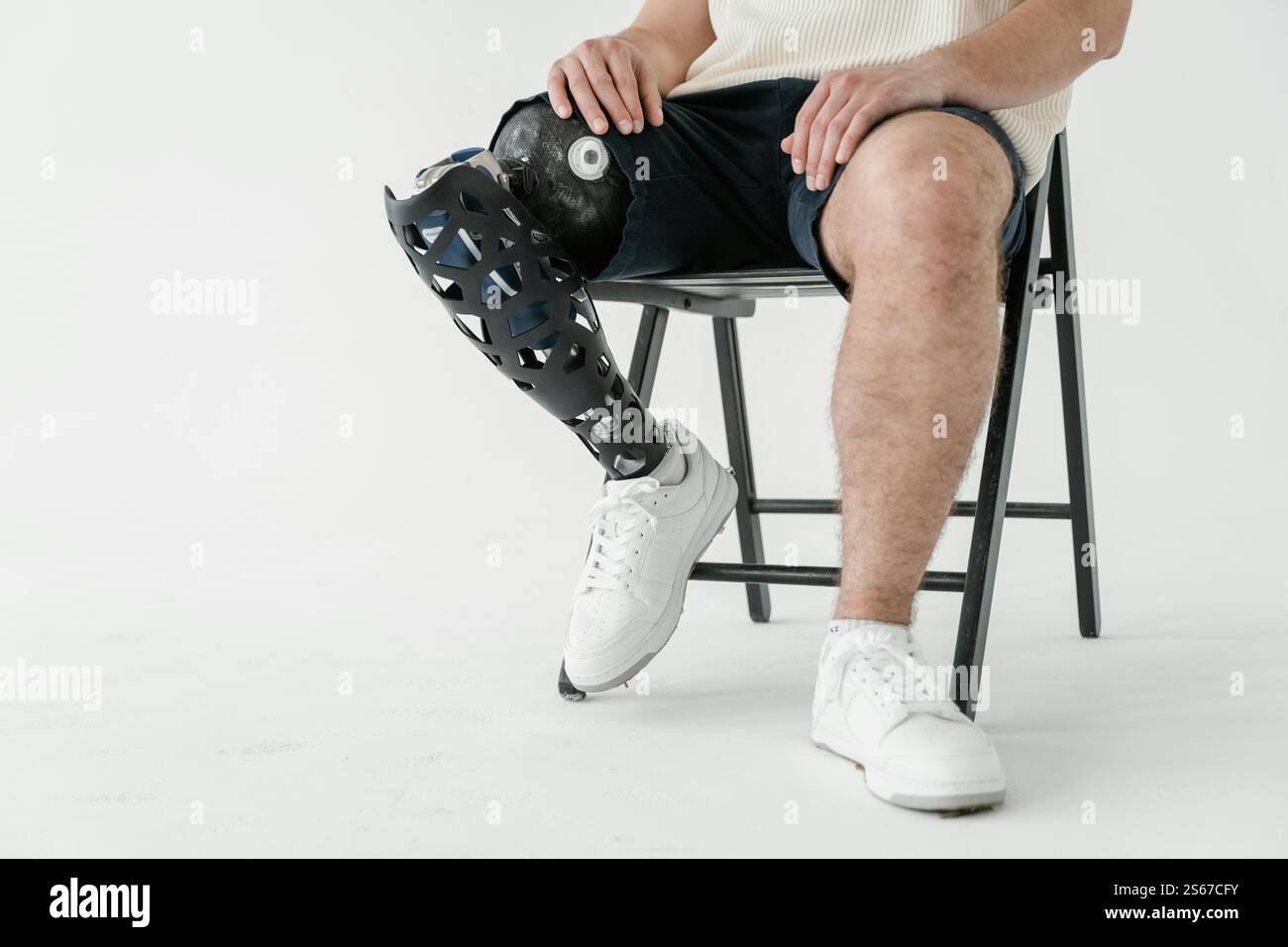 A Man with a prosthetic leg Sitting on Stool Stock Photo - Alamy