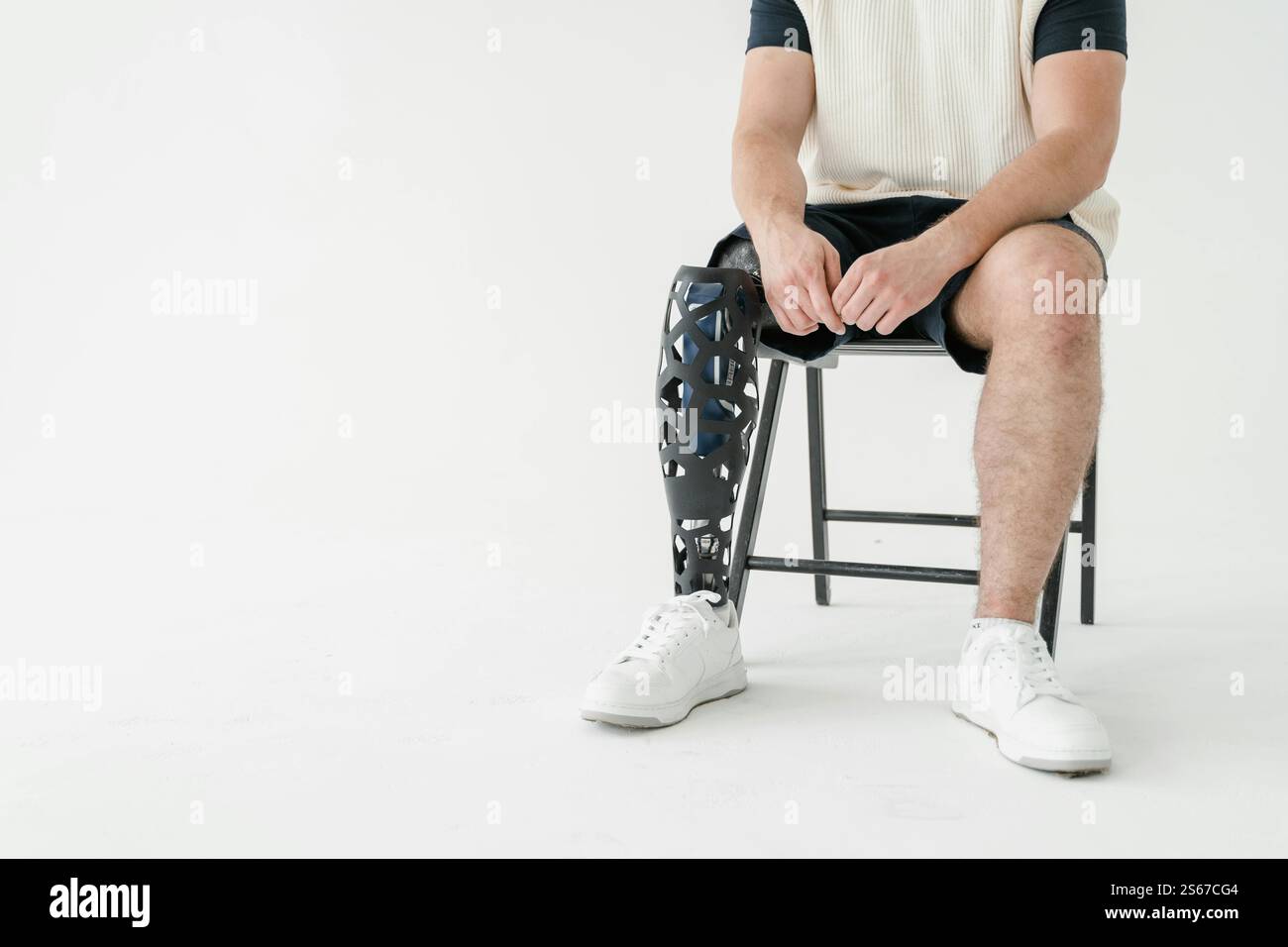 A Man with a prosthetic leg Sitting on Stool Stock Photo - Alamy