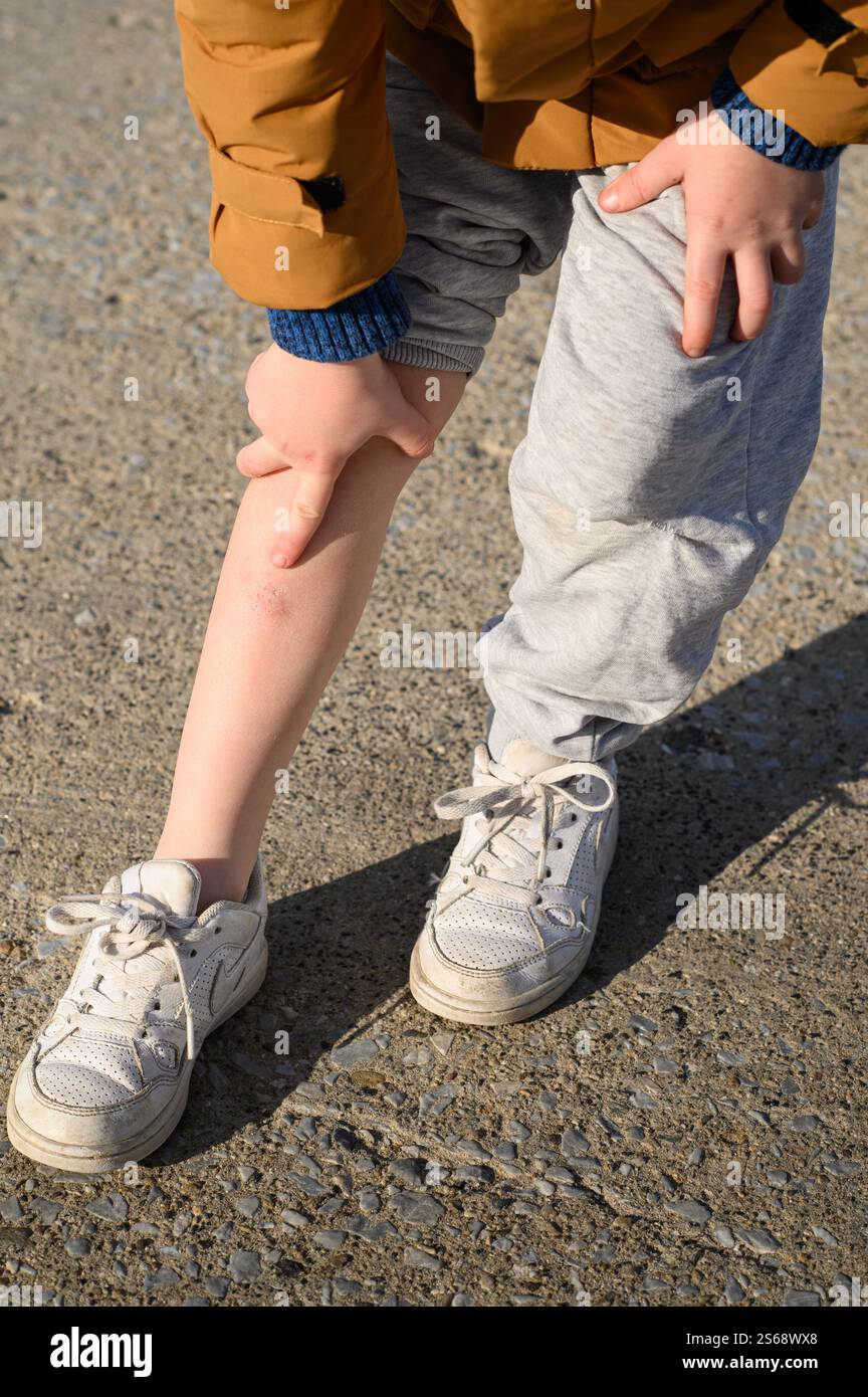 A child sits on the asphalt with a scraped knee, looking upset after a ...