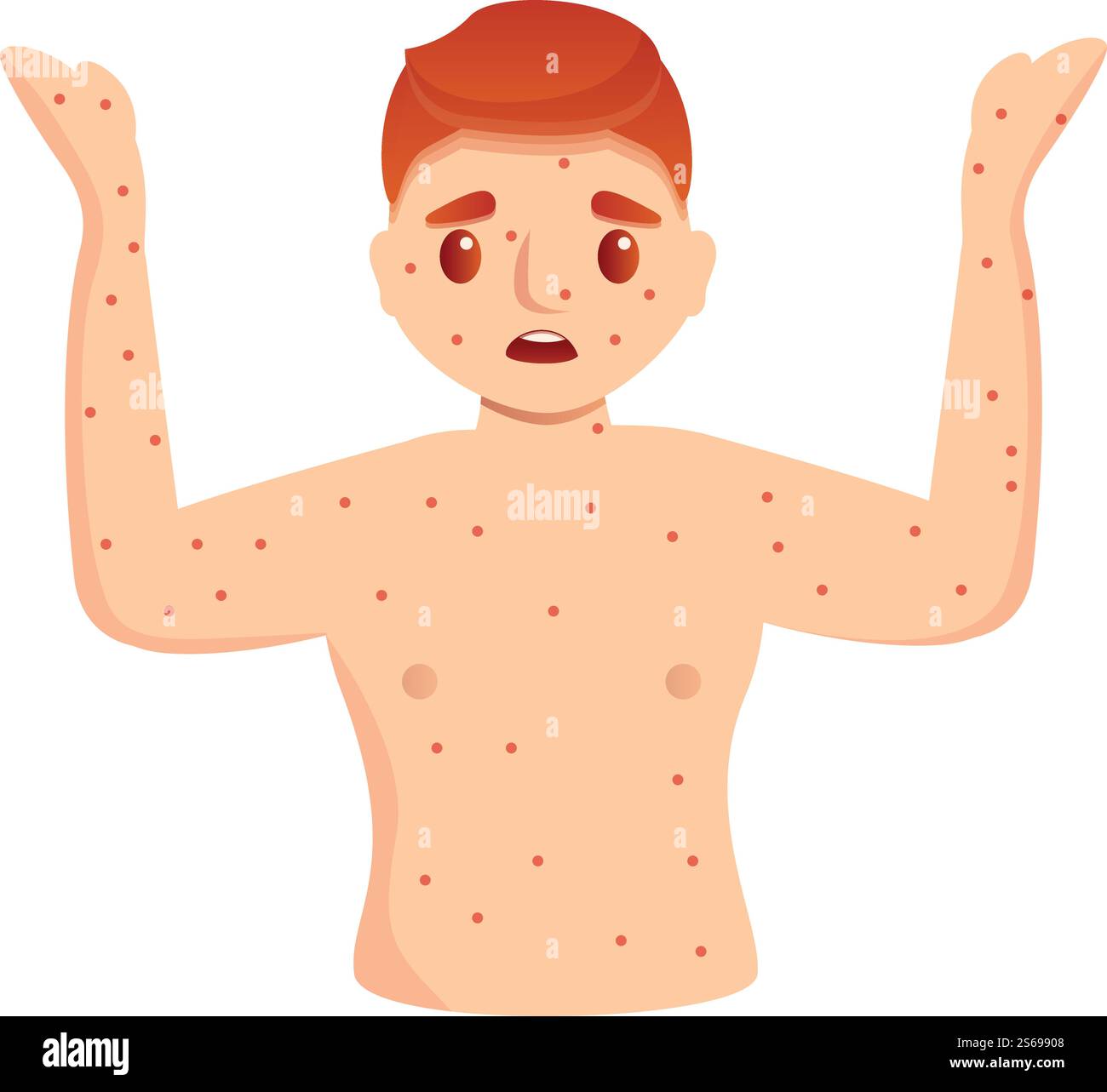 Health care measles icon. Cartoon of health care measles vector icon ...