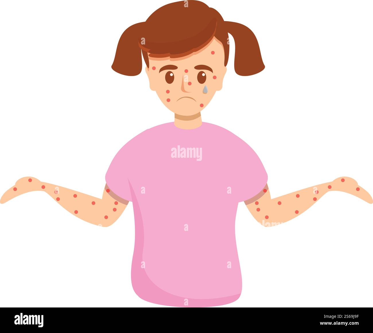 Measles Animation