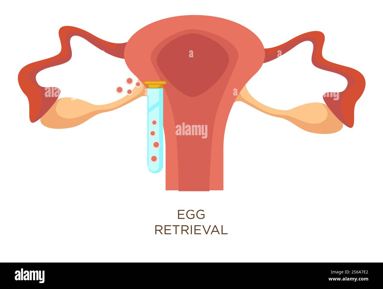 In vitro fertilization egg retrieval stage artificial insemination ...