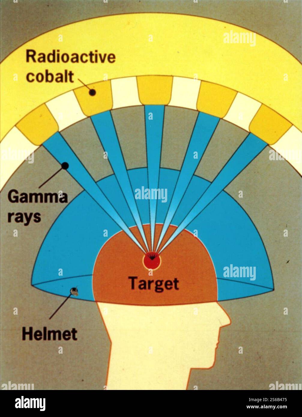 Gamma Knife Graphic Stock Photo - Alamy