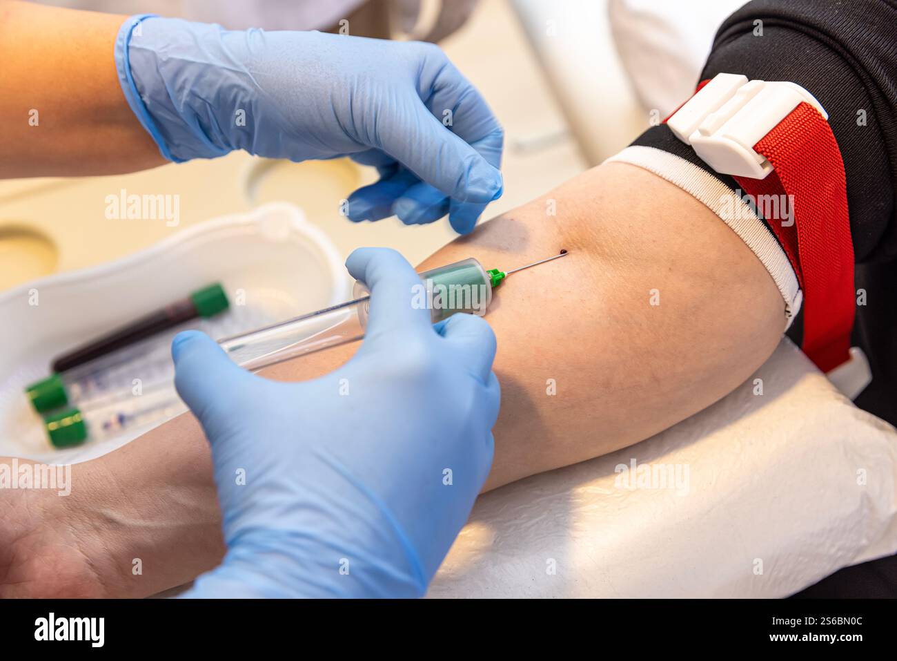 Doctor or nurse taking a blood sample from arm vein with a vacutainer ...