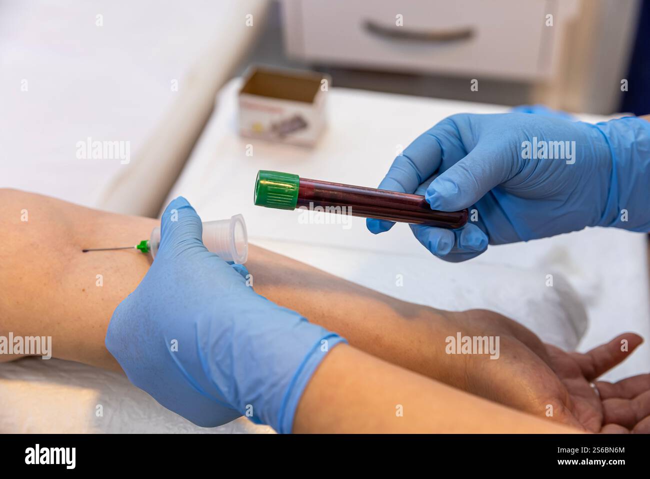 Doctor or nurse taking a blood sample from arm vein with a vacutainer. Venipuncture or ...