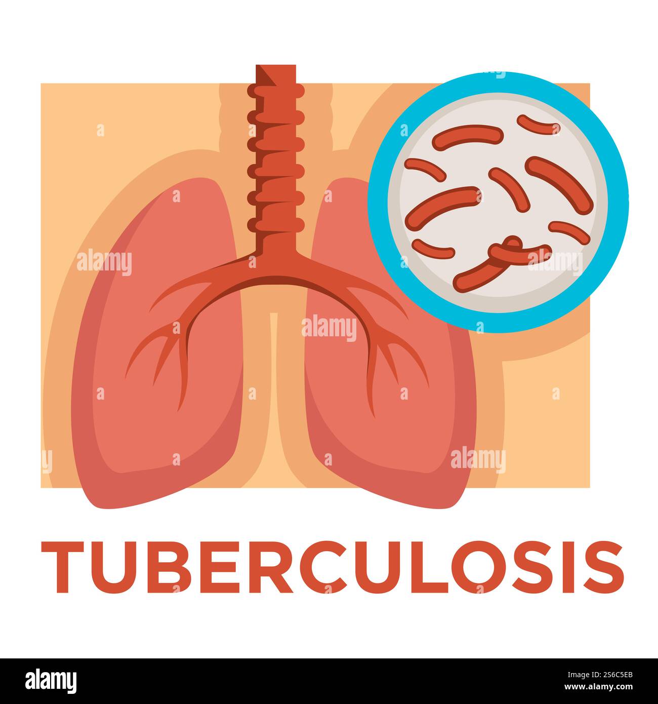 Lungs of infected person, mycobacterium tuberculosis isolated icon ...