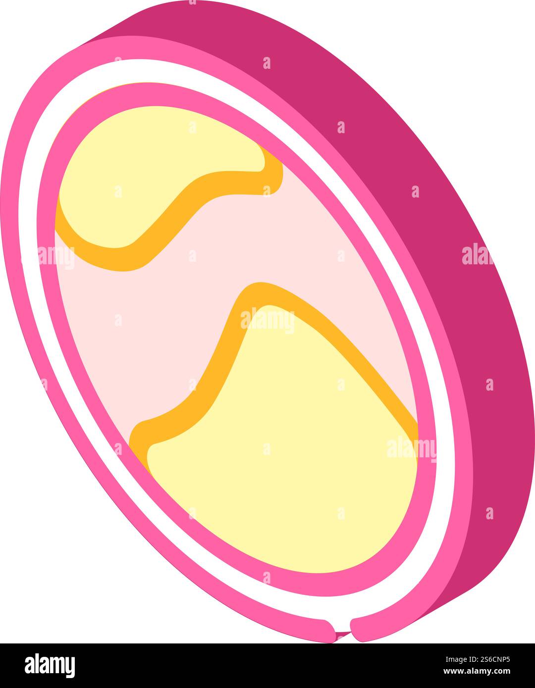 atherosclerosis heart isometric icon vector. atherosclerosis heart sign ...