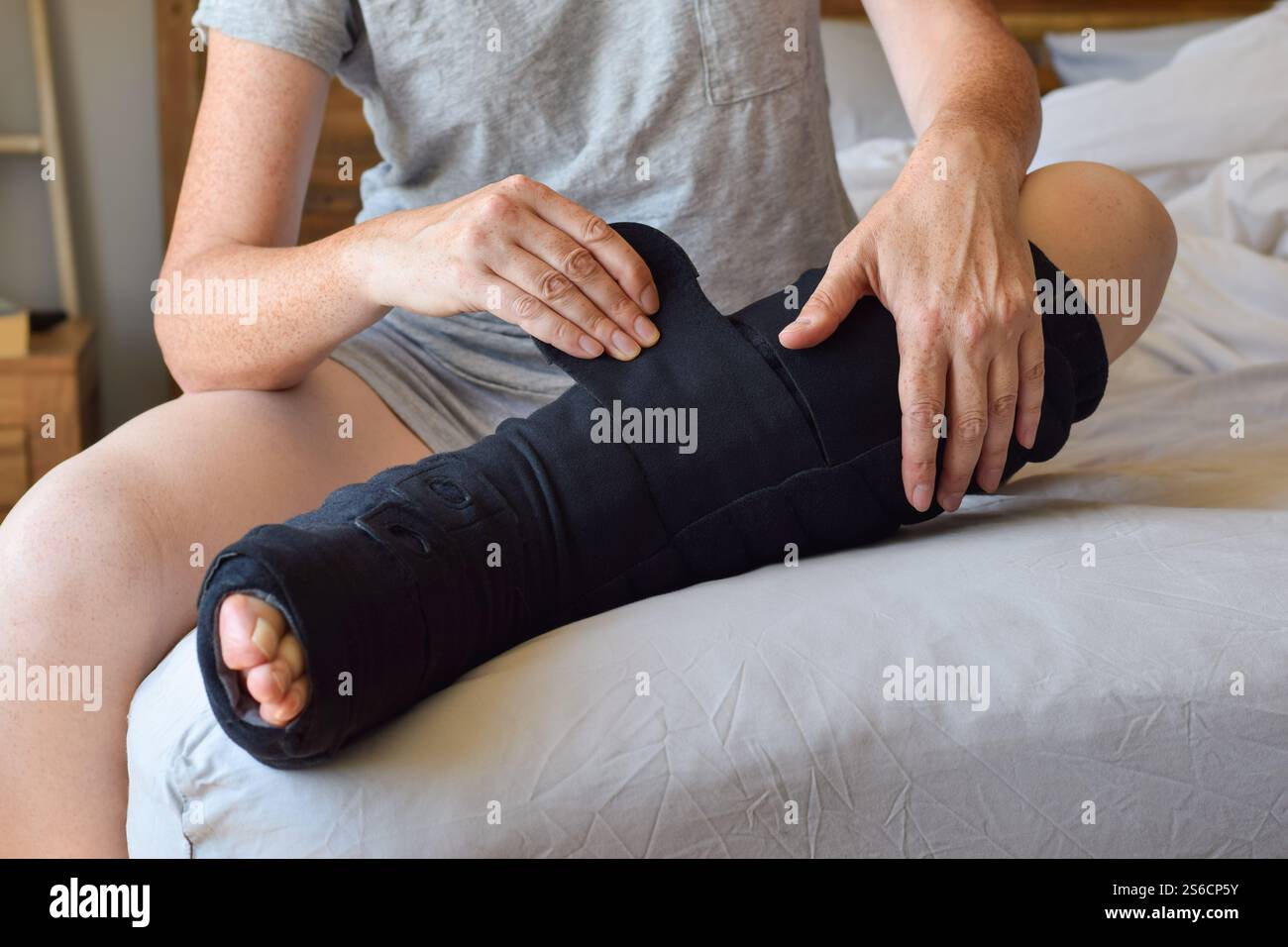 Woman sitting on bed putting on night compression wrap on lymphedema ...