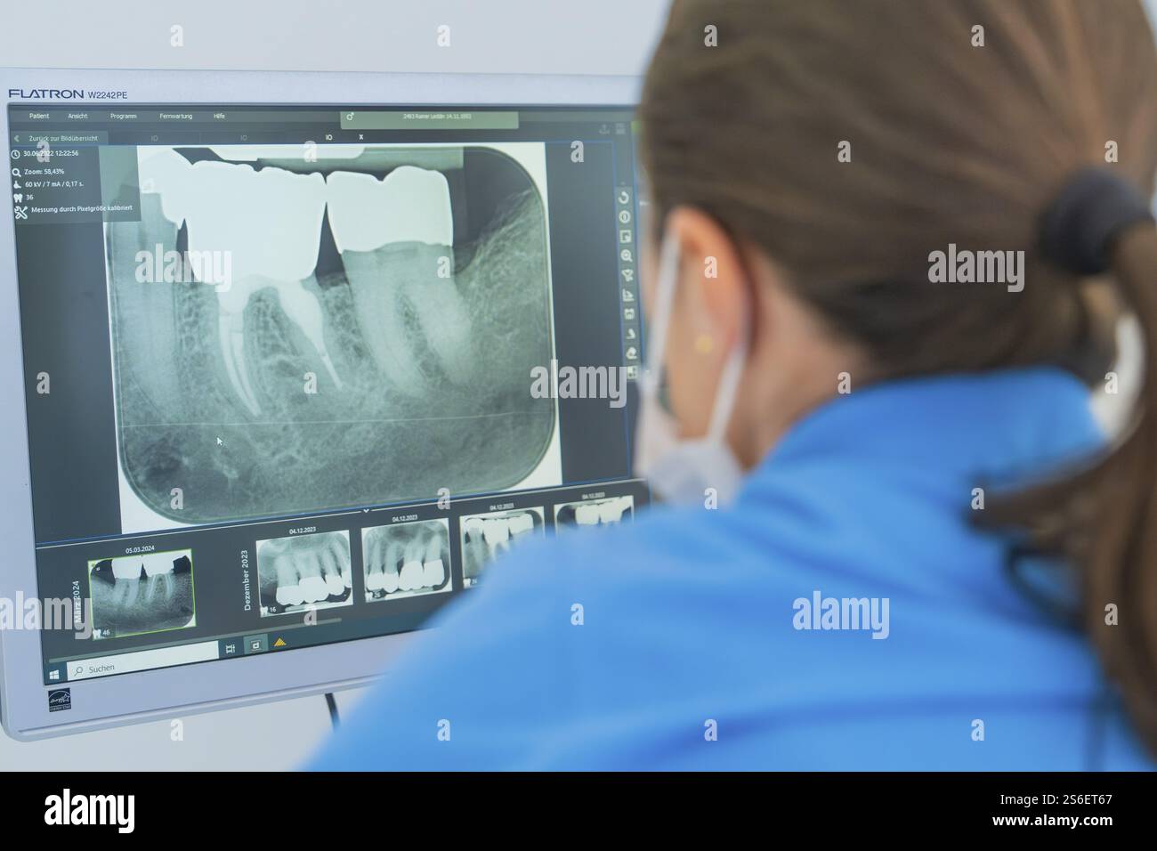 Dentist analysing X-ray images of teeth on a computer screen, dental ...