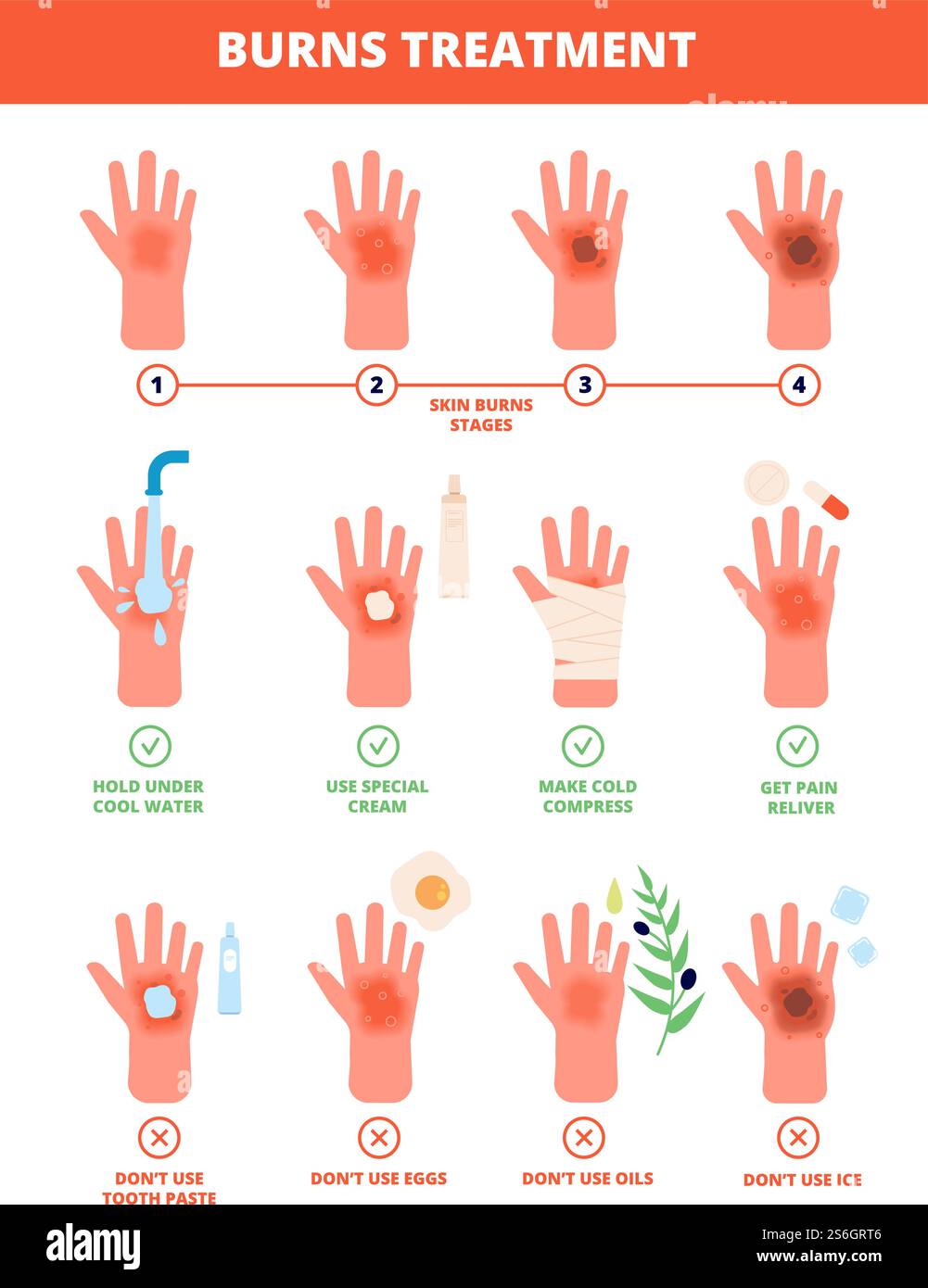 Skin burn. Burned hand treating, protection burns. First aid and ...