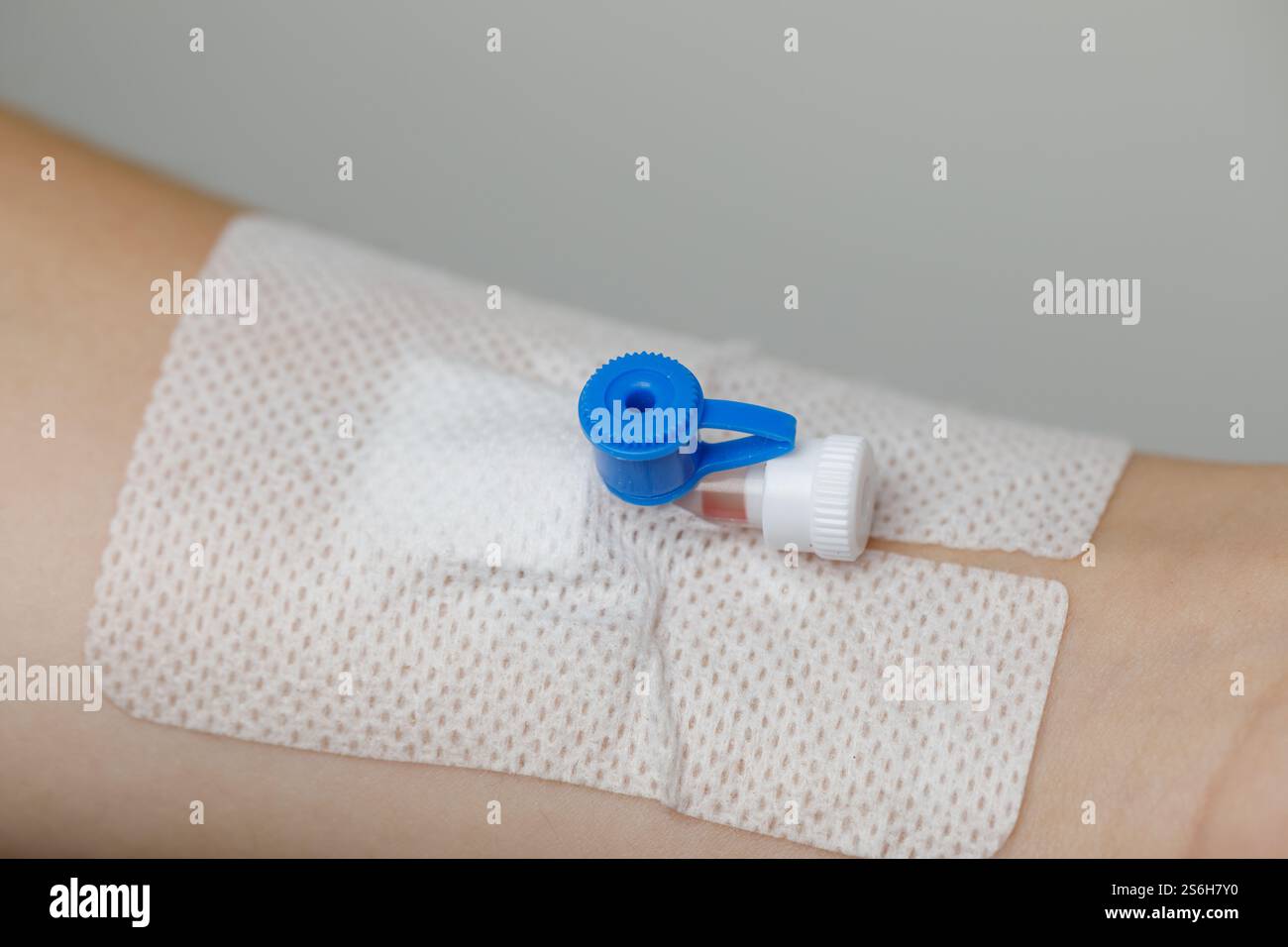 Blue and white color Peripheral intravenous catheter in hand Stock ...