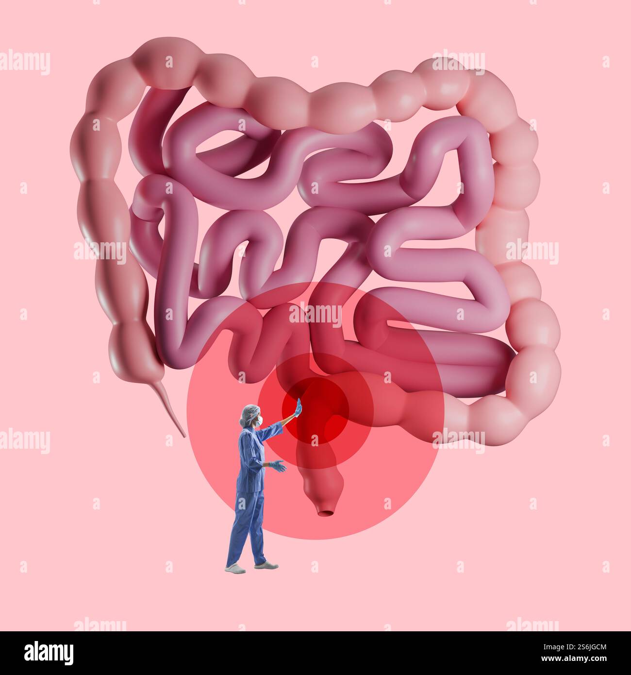 Doctor examining large intestine with red markers highlighting areas of ...