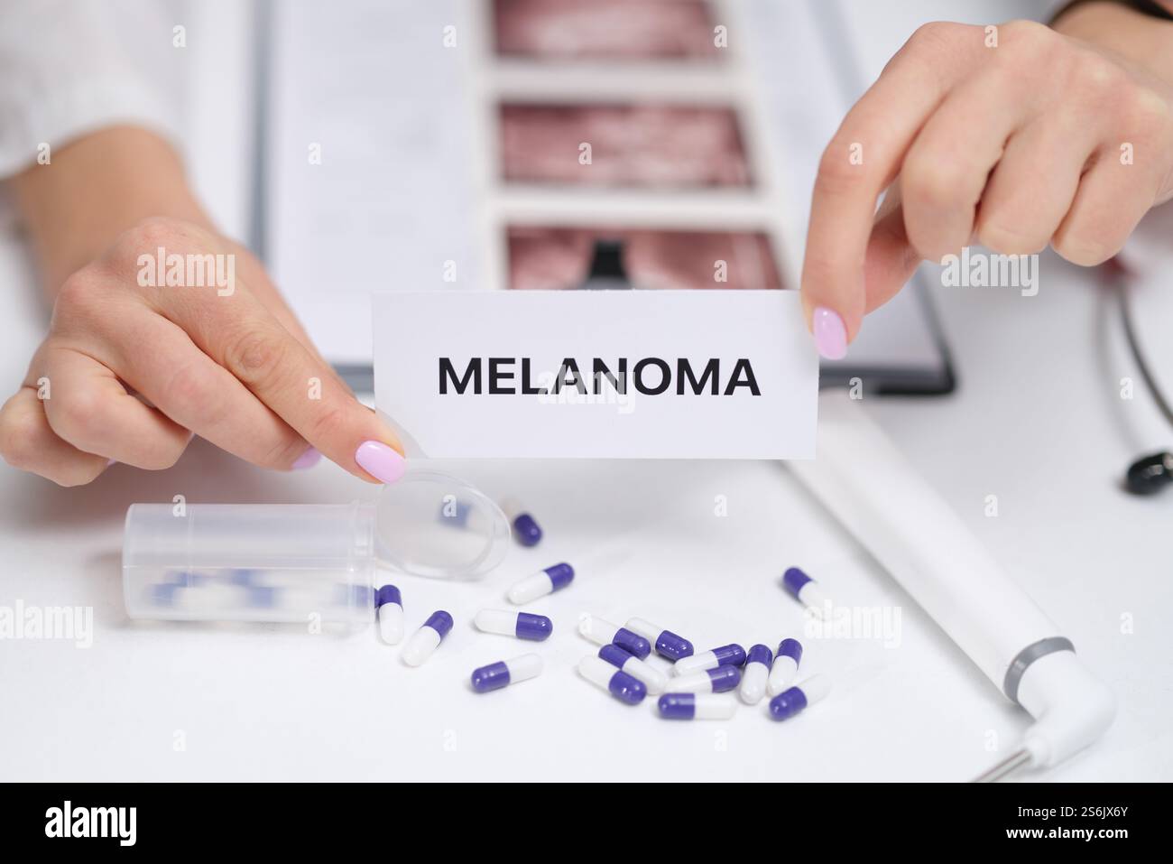 Deepening Our Understanding of Melanoma The Importance of Awareness and ...