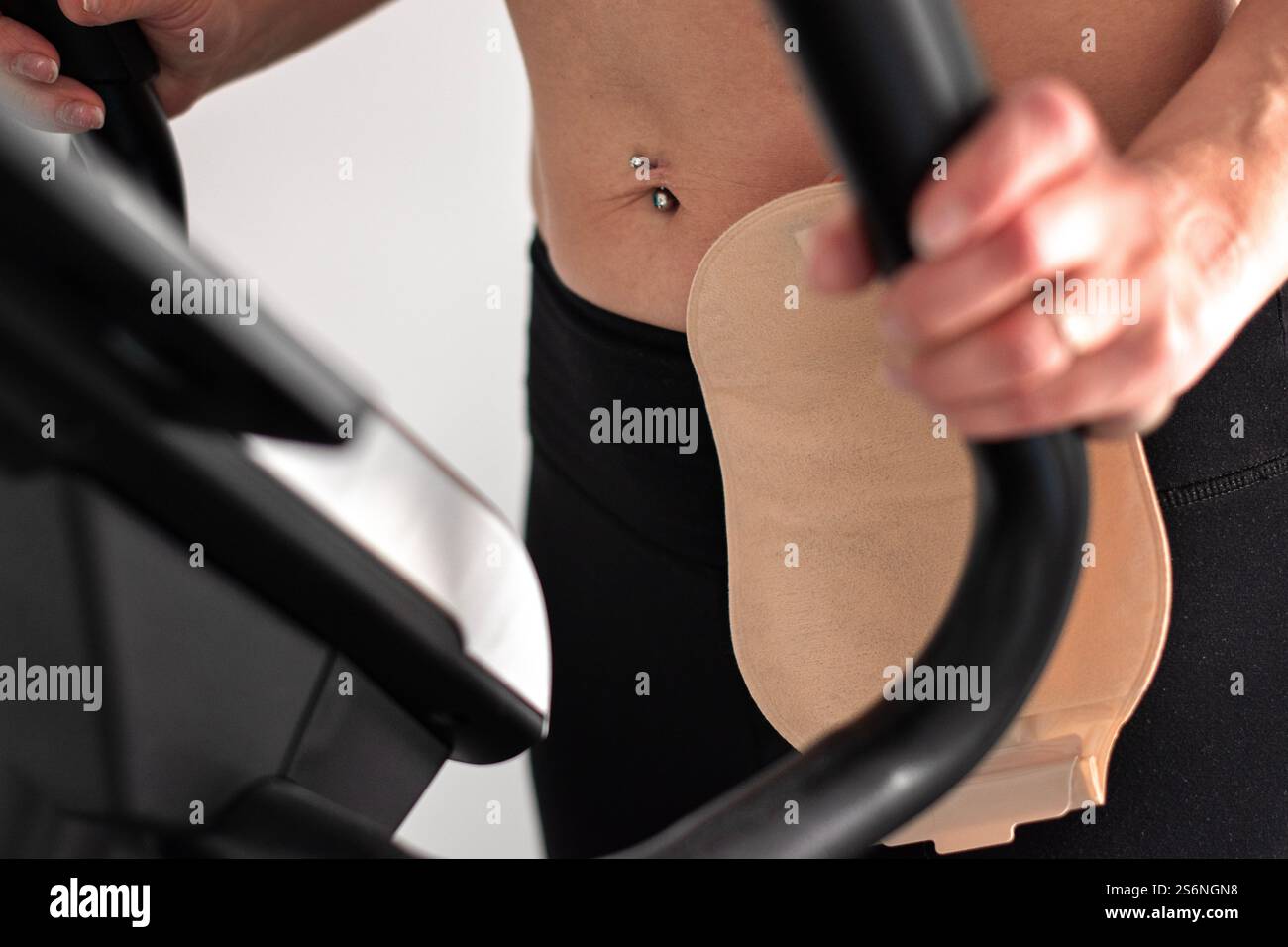 View on colostomy pouch attached to a woman patient workout at a gym ...
