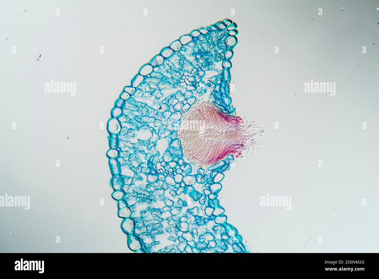 Uromyces microscope hi-res stock photography and images - Alamy