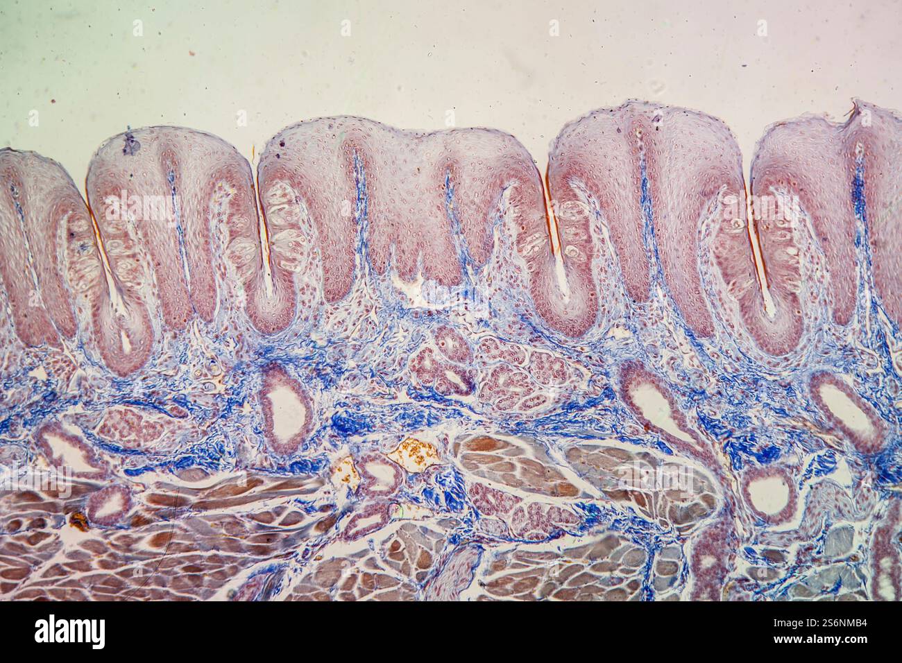 Red papillae hi-res stock photography and images - Alamy