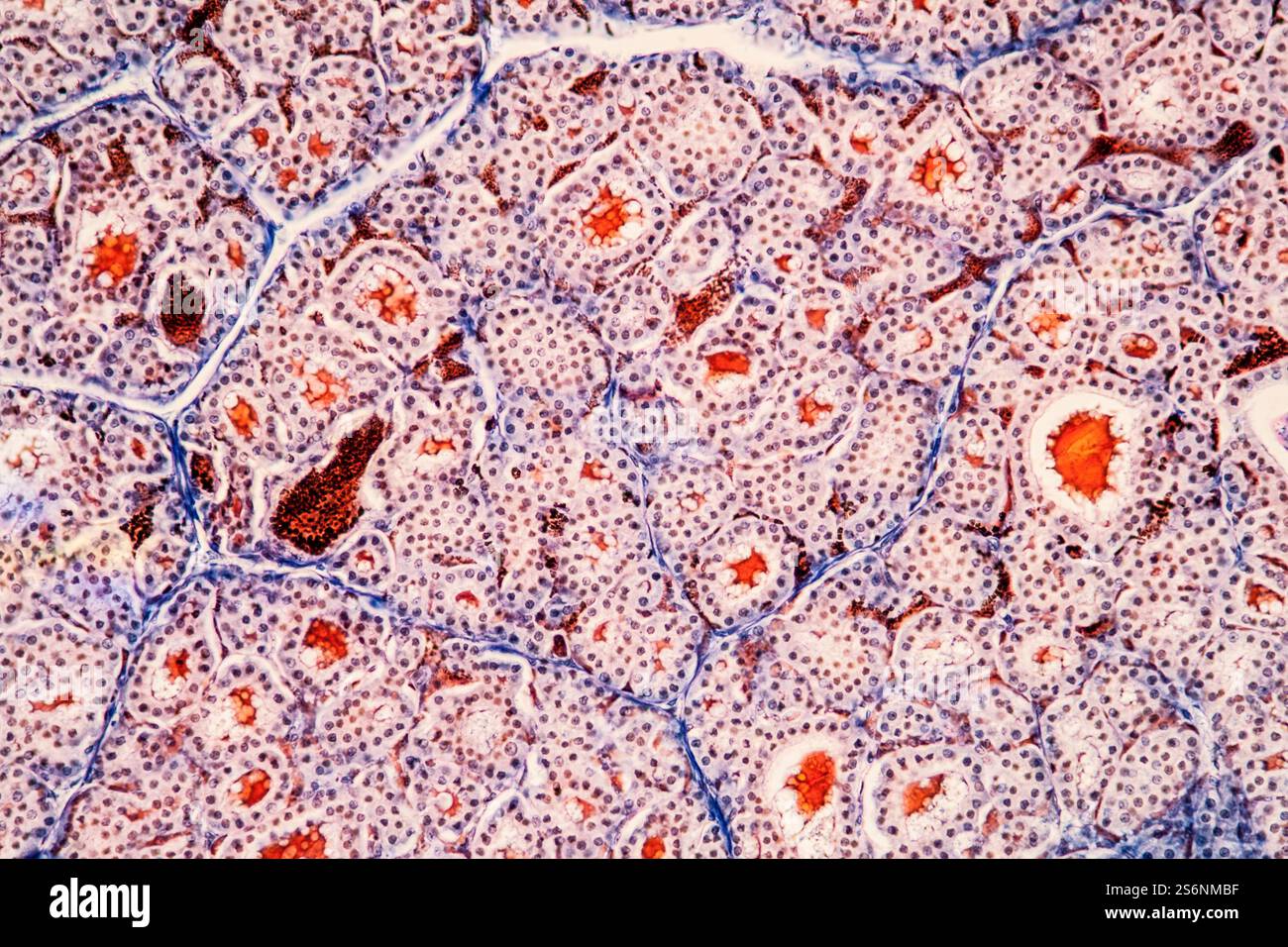Thyroid tissue under the microscope 200x Stock Photo - Alamy