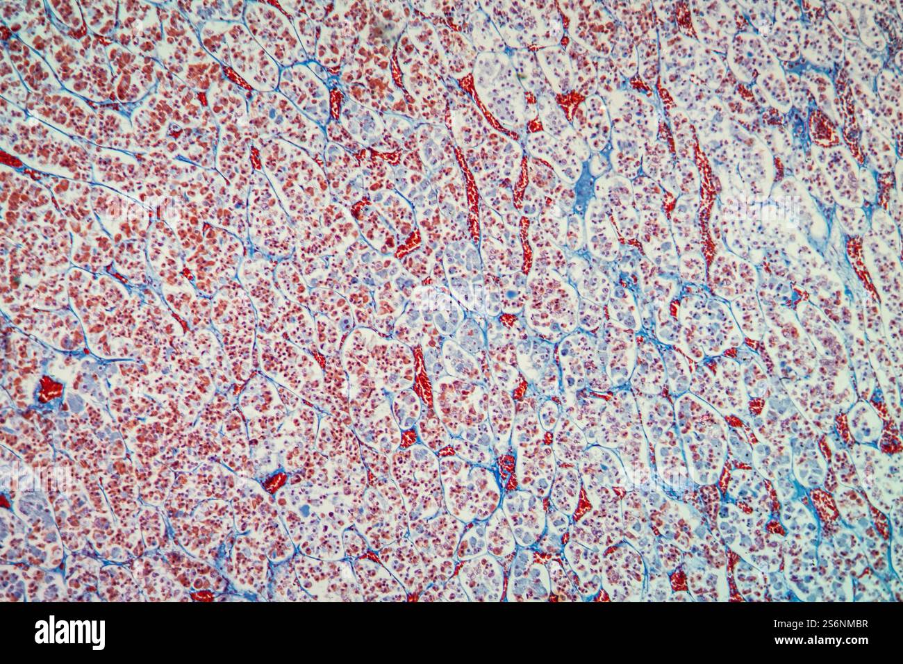 Hypothalamus pituitary gland hi-res stock photography and images - Alamy