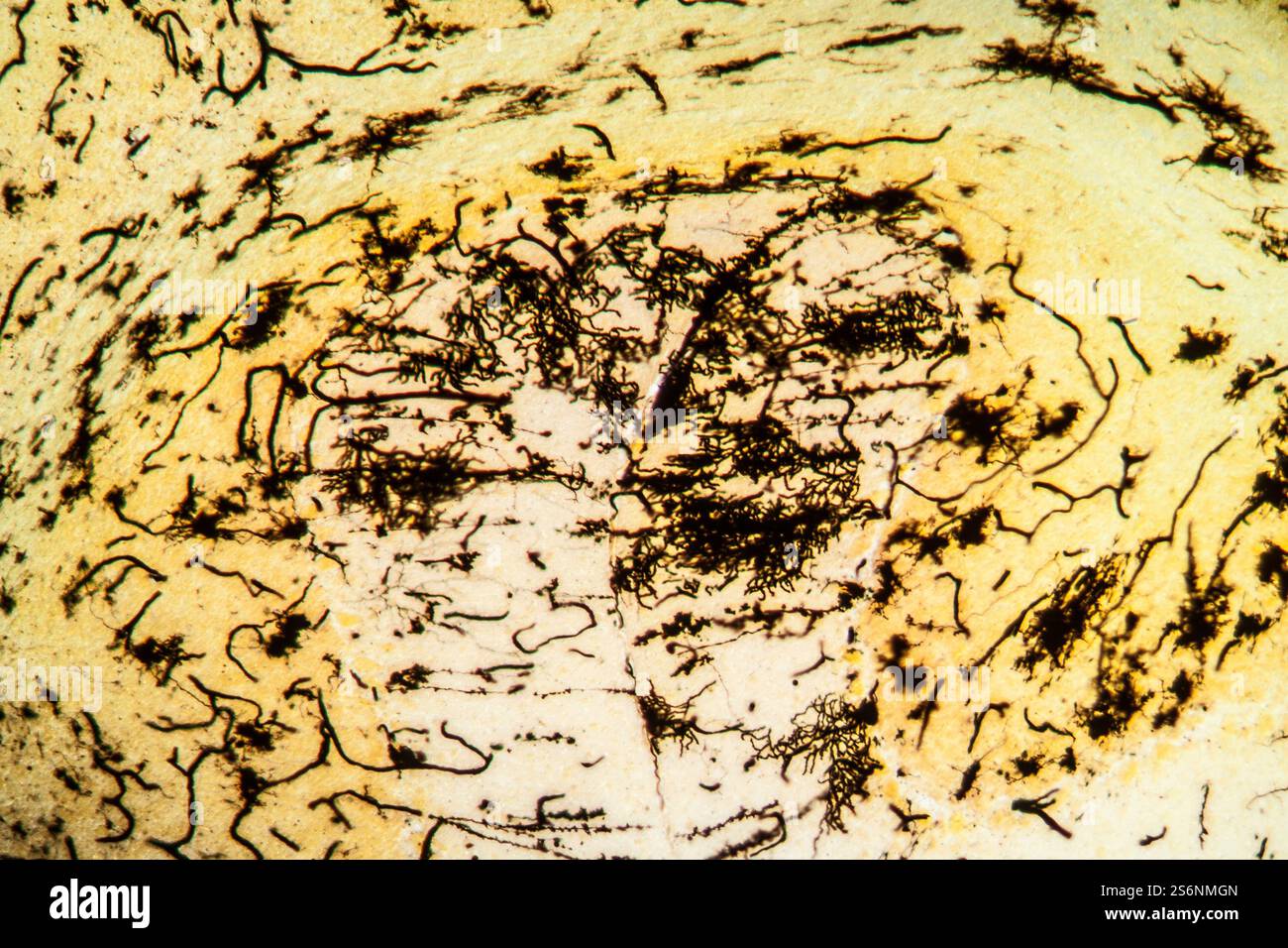 Brain tissue under the microscope 100x Stock Photo - Alamy