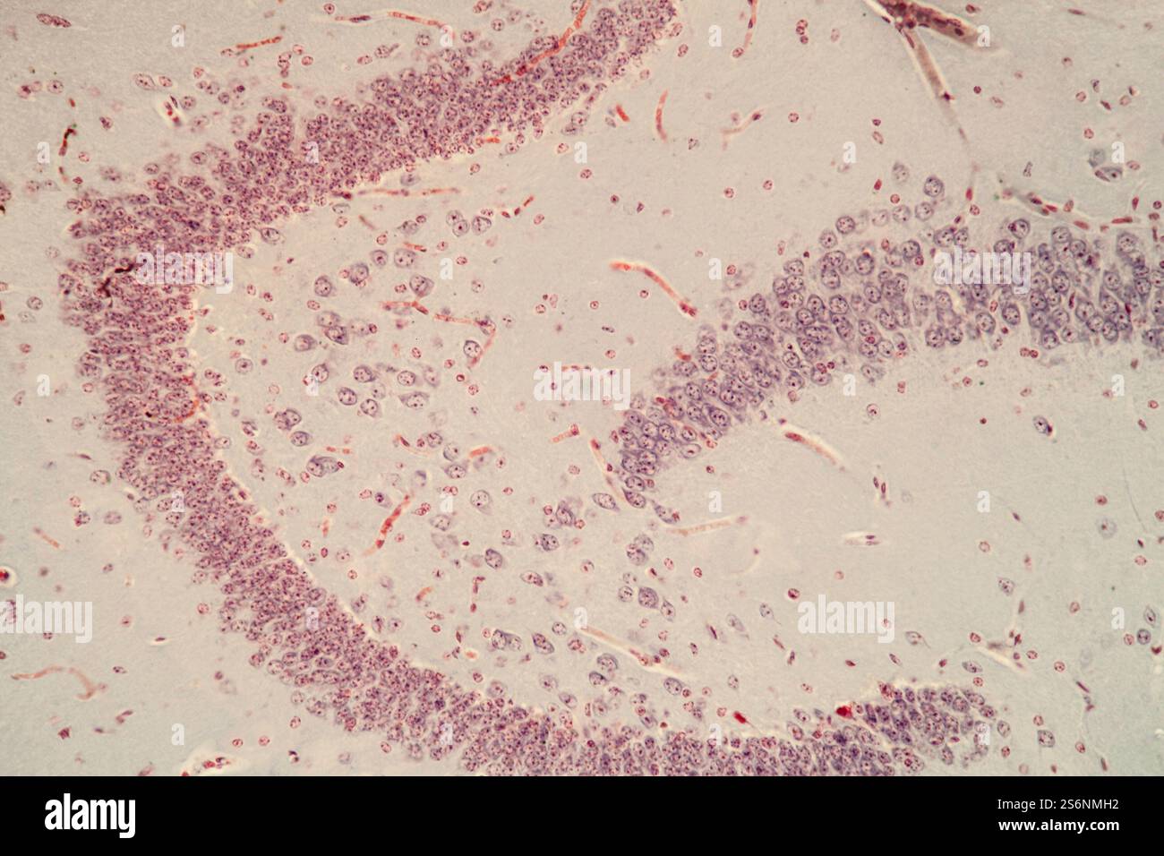 Brain tissue under the microscope 100x Stock Photo - Alamy
