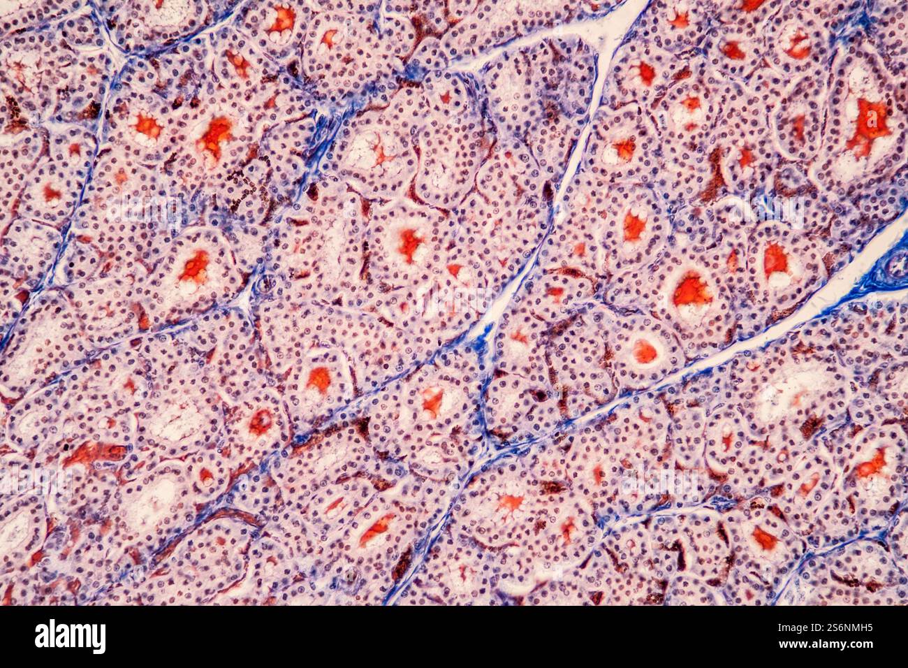 Thyroid tissue under the microscope 200x Stock Photo - Alamy