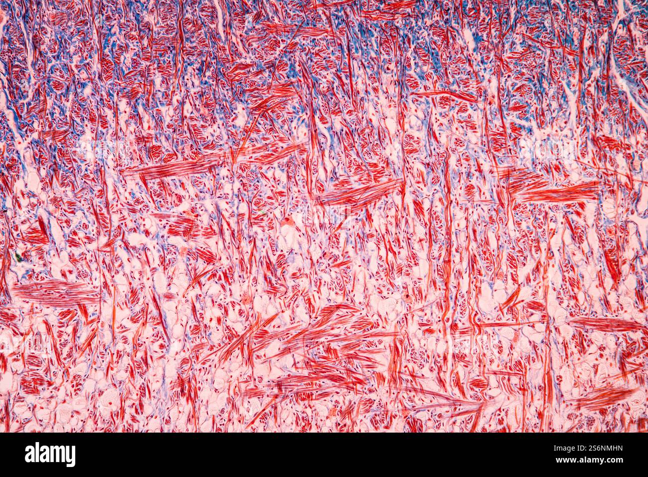 Foot glands hi-res stock photography and images - Alamy