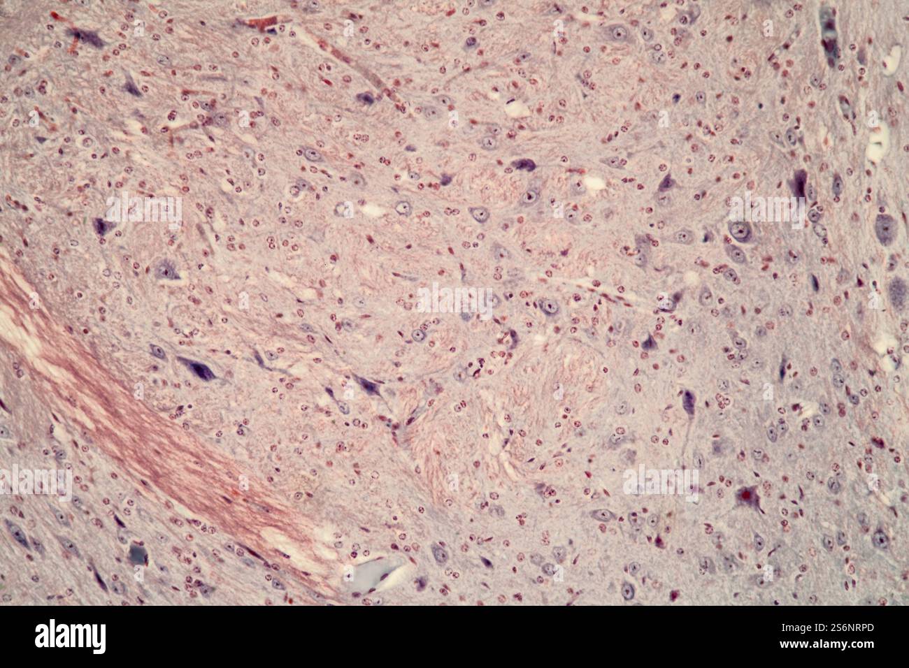 Brain tissue under the microscope 100x Stock Photo - Alamy