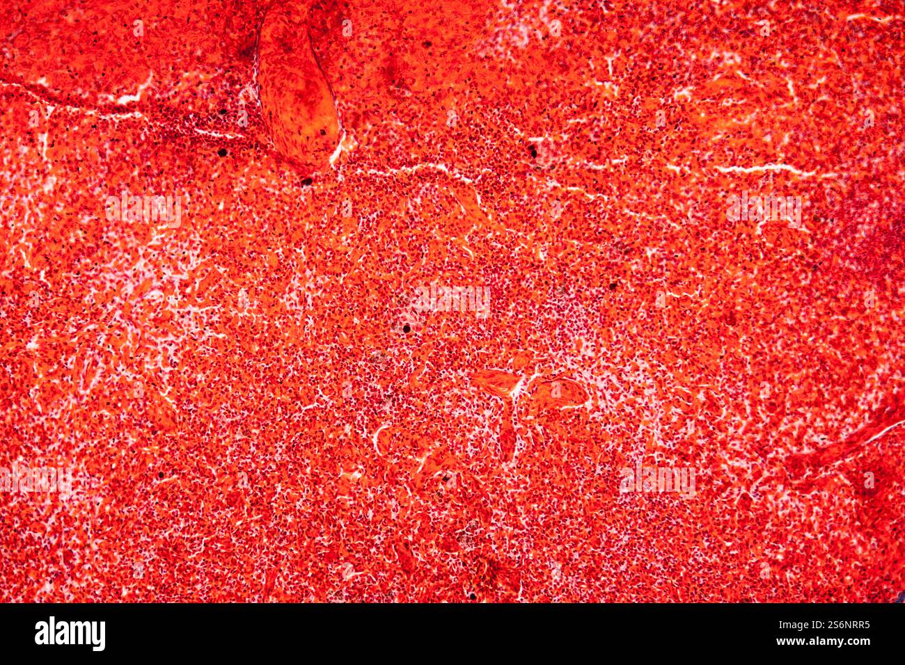 Spleen tissue under the microscope 100x Stock Photo - Alamy