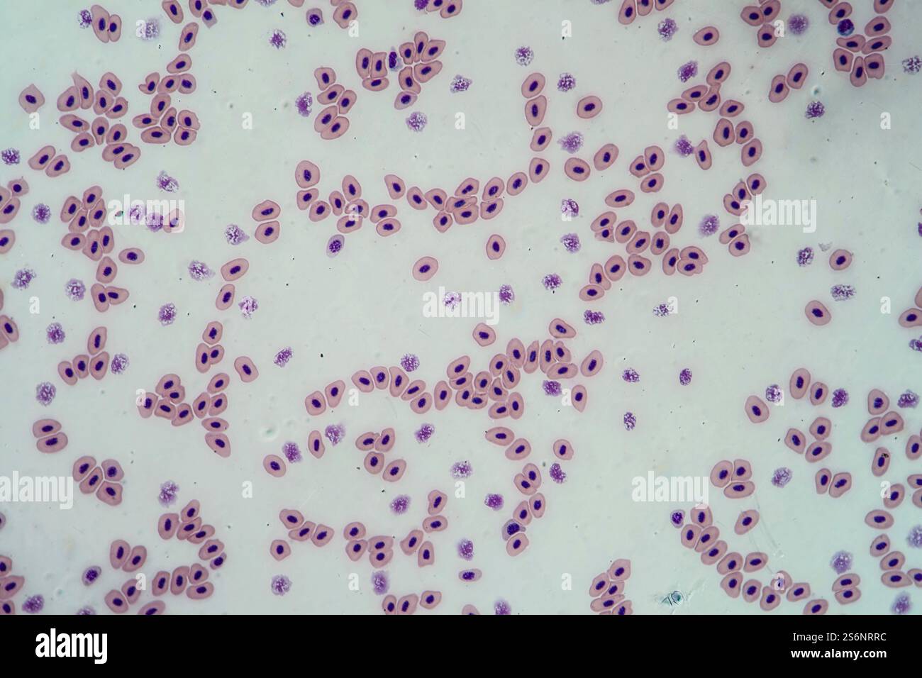 Blood smear red blood cells hi-res stock photography and images - Alamy