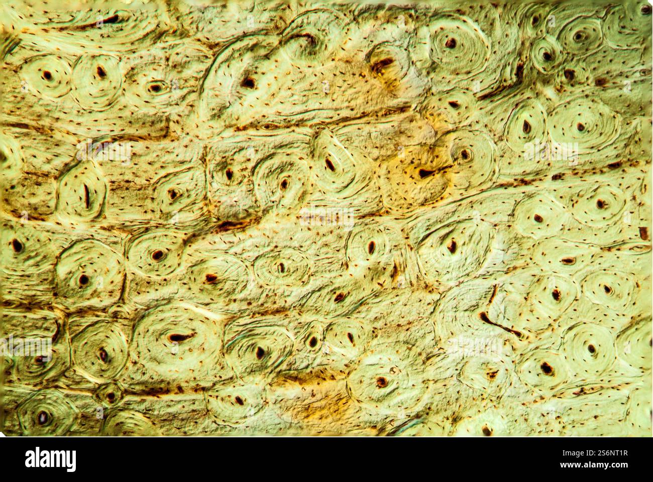 Bone cross section 100x Stock Photo - Alamy
