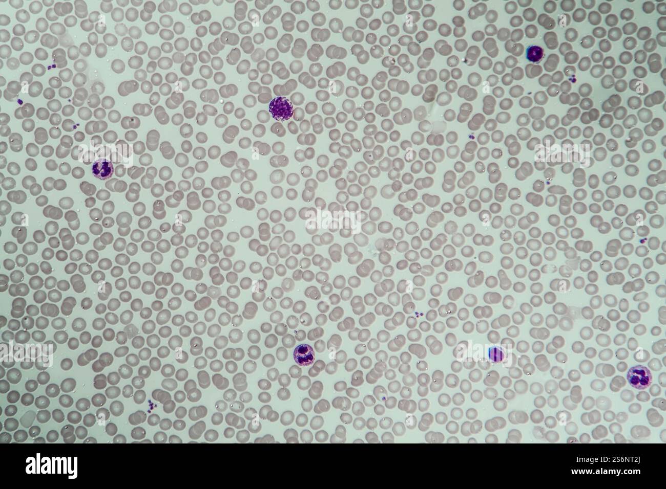 Human red white blood cells hi-res stock photography and images - Alamy