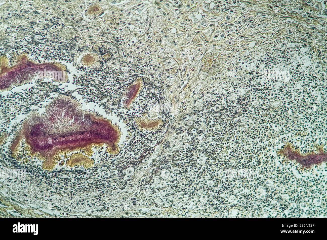 Fungal cell hi-res stock photography and images - Alamy