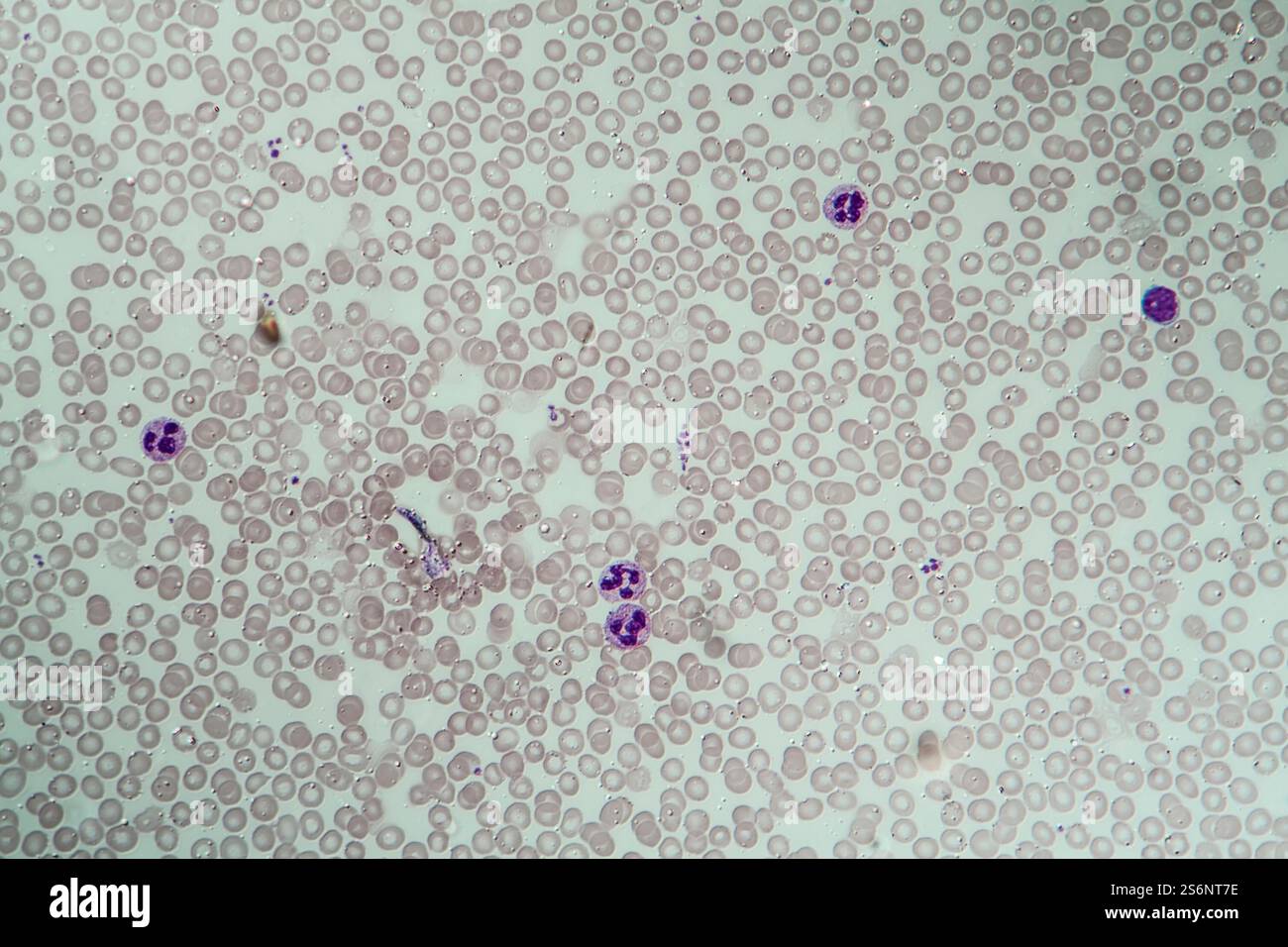 Red and white blood cells 400x Stock Photo - Alamy