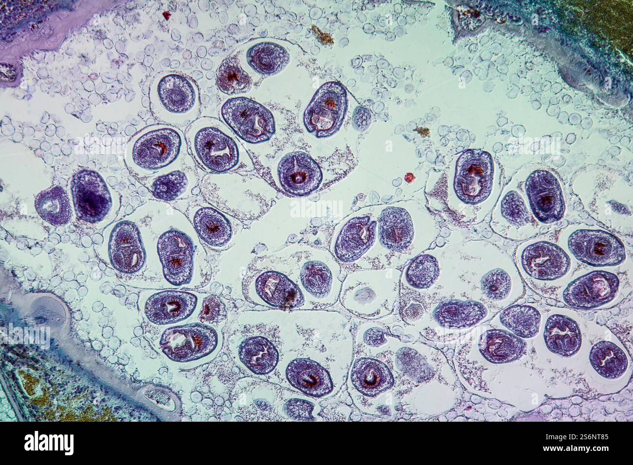 Worms in infected liver 100x Stock Photo - Alamy