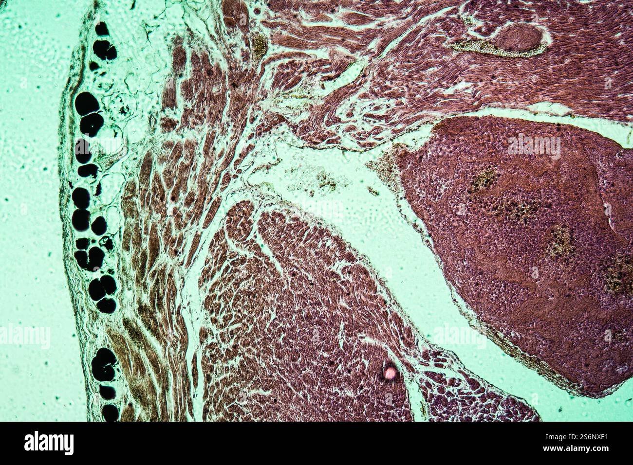 Skin cancer affected tissue 100x Stock Photo - Alamy