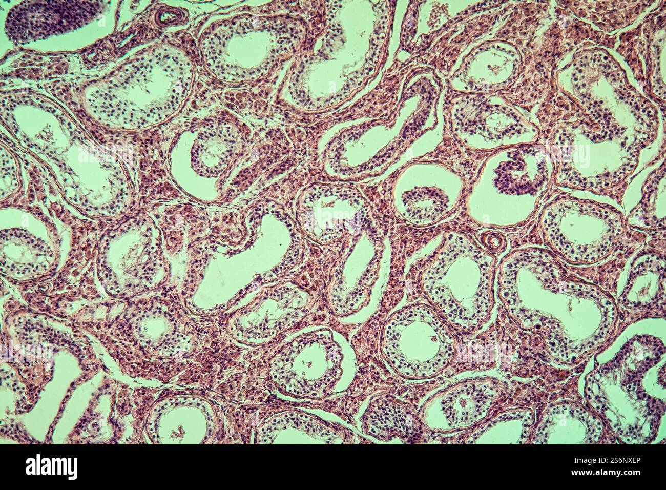 Undescended hi-res stock photography and images - Alamy