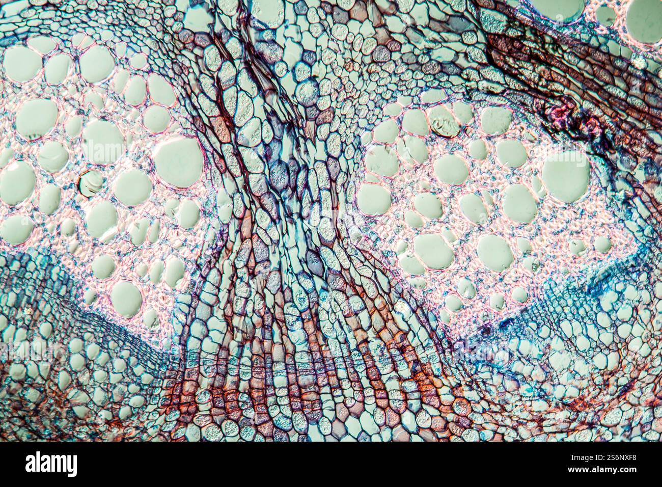 Pipe bush stem t.s. 100x Stock Photo - Alamy