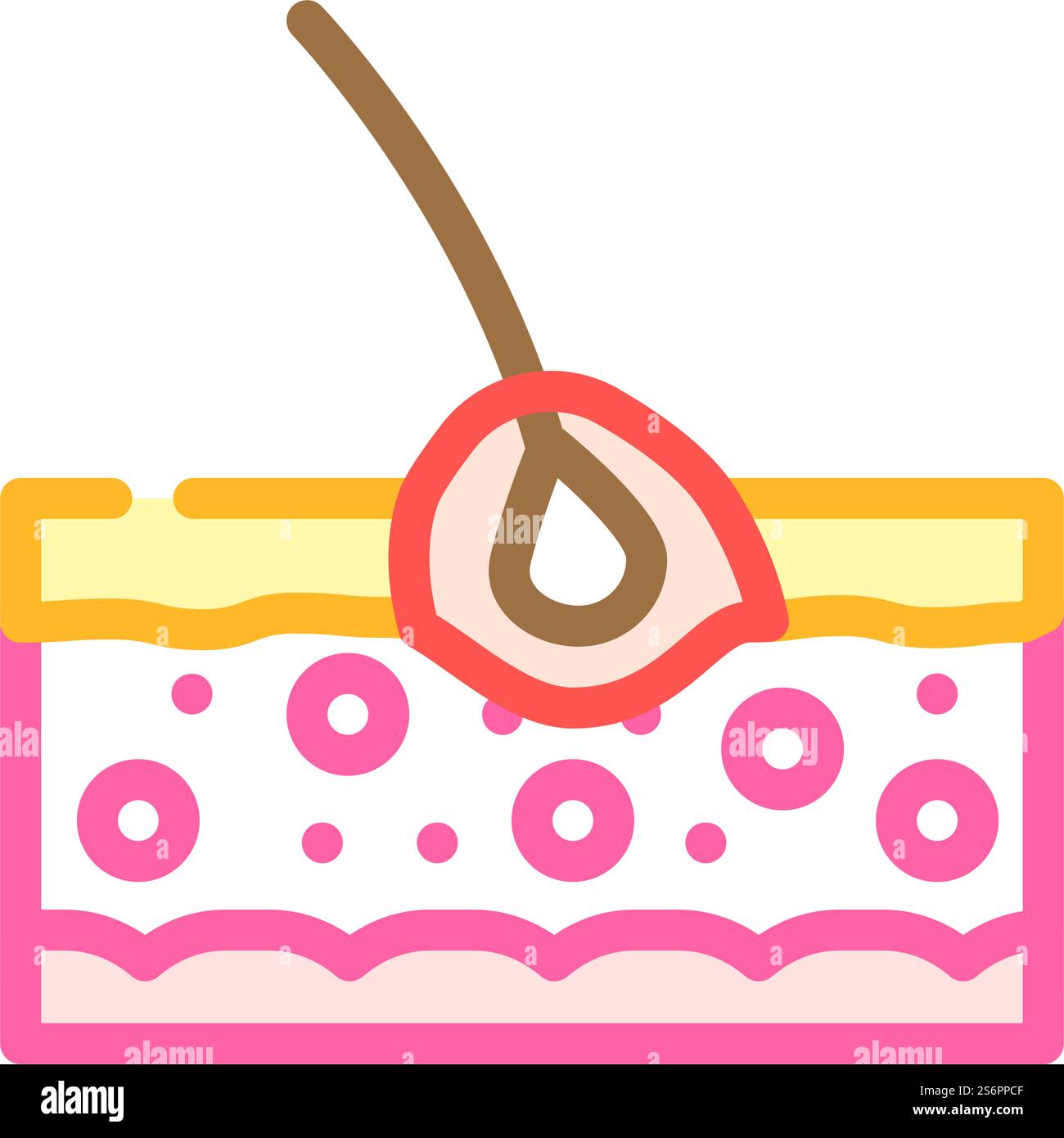 folliculitis skin disease problem color icon vector. folliculitis skin ...