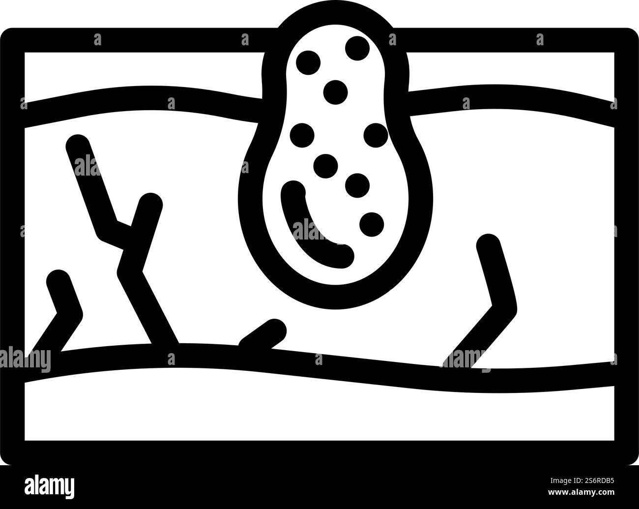 acne skin problem line icon vector. acne skin problem sign. isolated ...