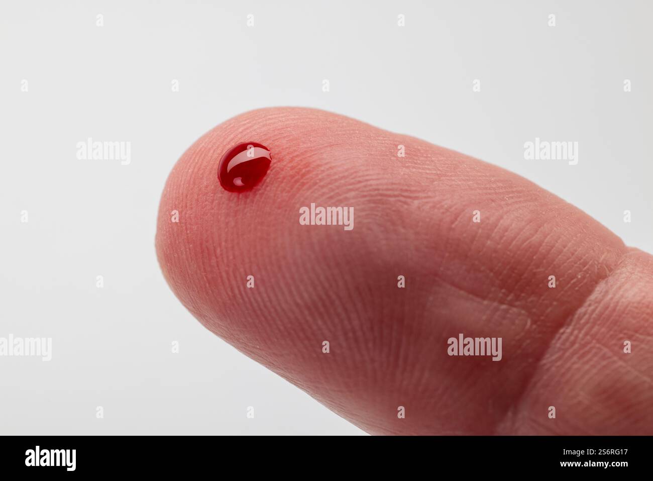 Drop of blood from the fingertip, small blood sample, capillary blood ...
