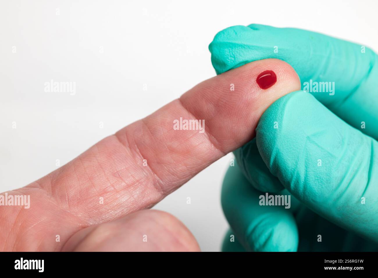 Drop of blood from the fingertip, small blood sample, capillary blood ...