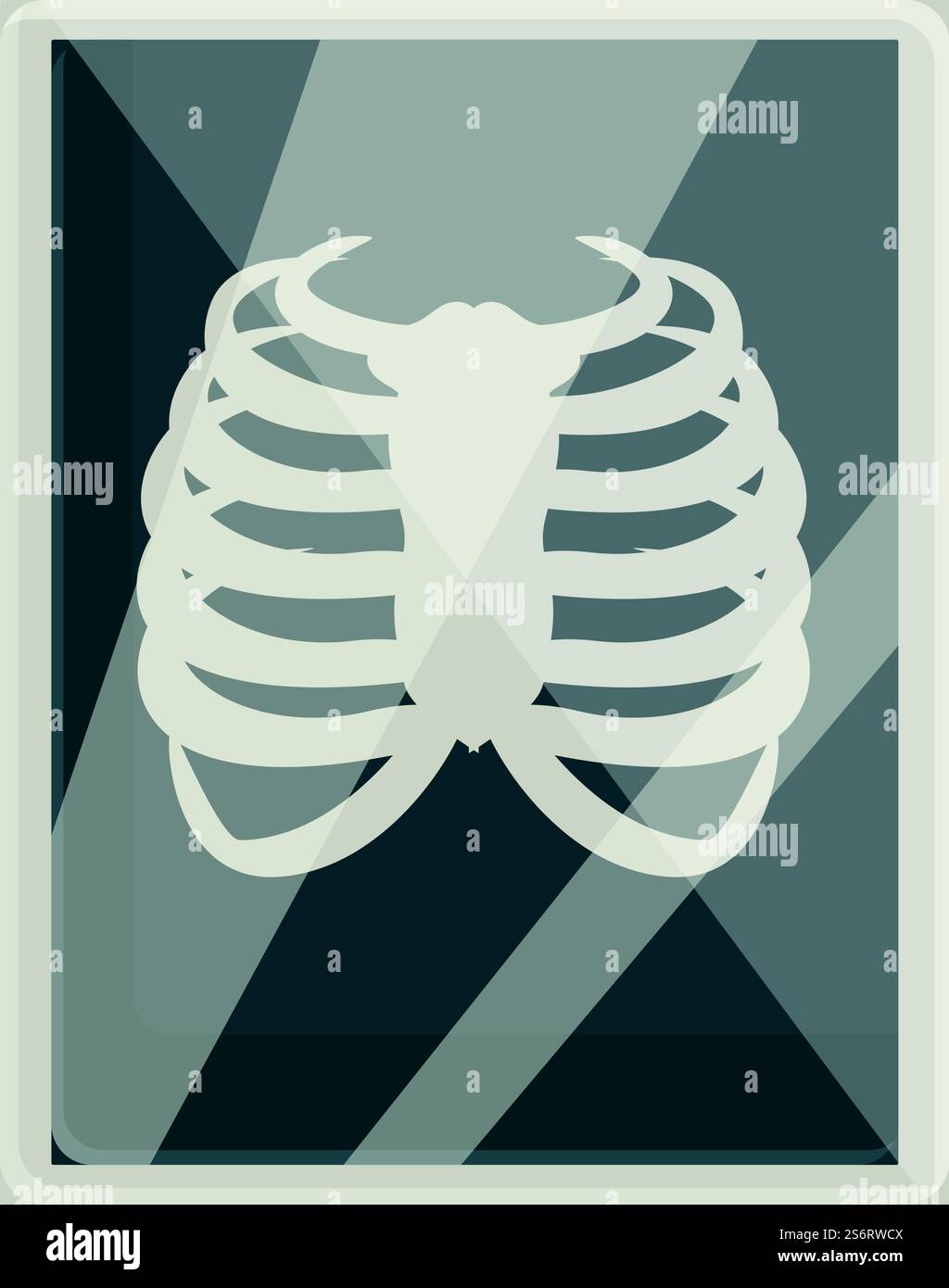 Chest x ray cartoon hi-res stock photography and images - Alamy