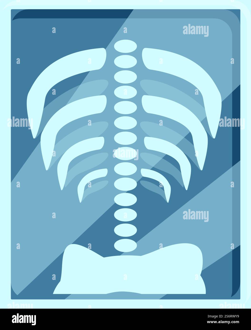 Xray new chest scan icon cartoon vector. Radiology doctor. Machine ...